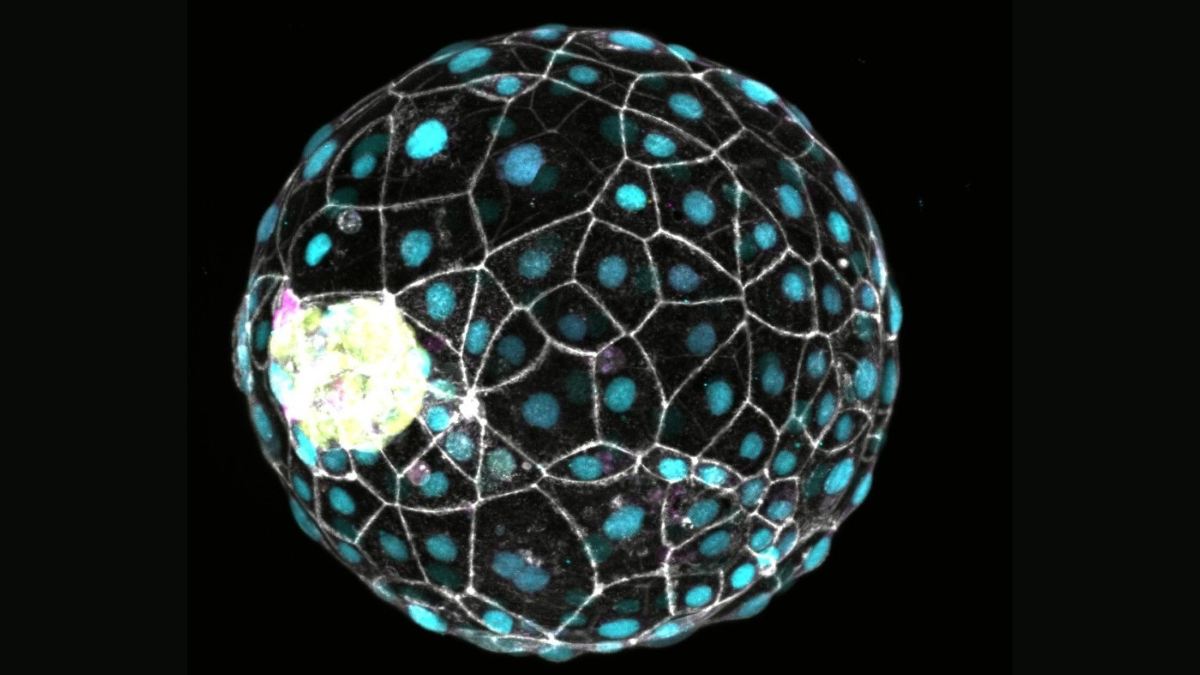 Could we hit the “pause button” on human embryo development? | News ...