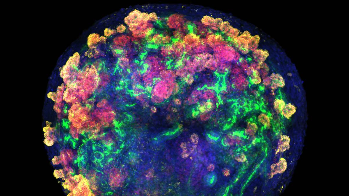 Pig kidneys enable scalable production of human kidney organoids | News ...