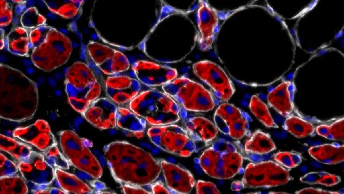 Protein linked to muscle regeneration may lead to treatment for frailty ...