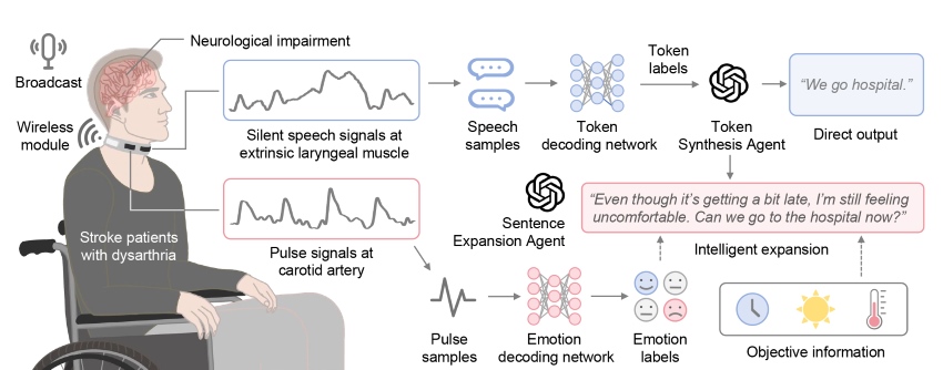 Throat device gives new voice to patients people with speech ...