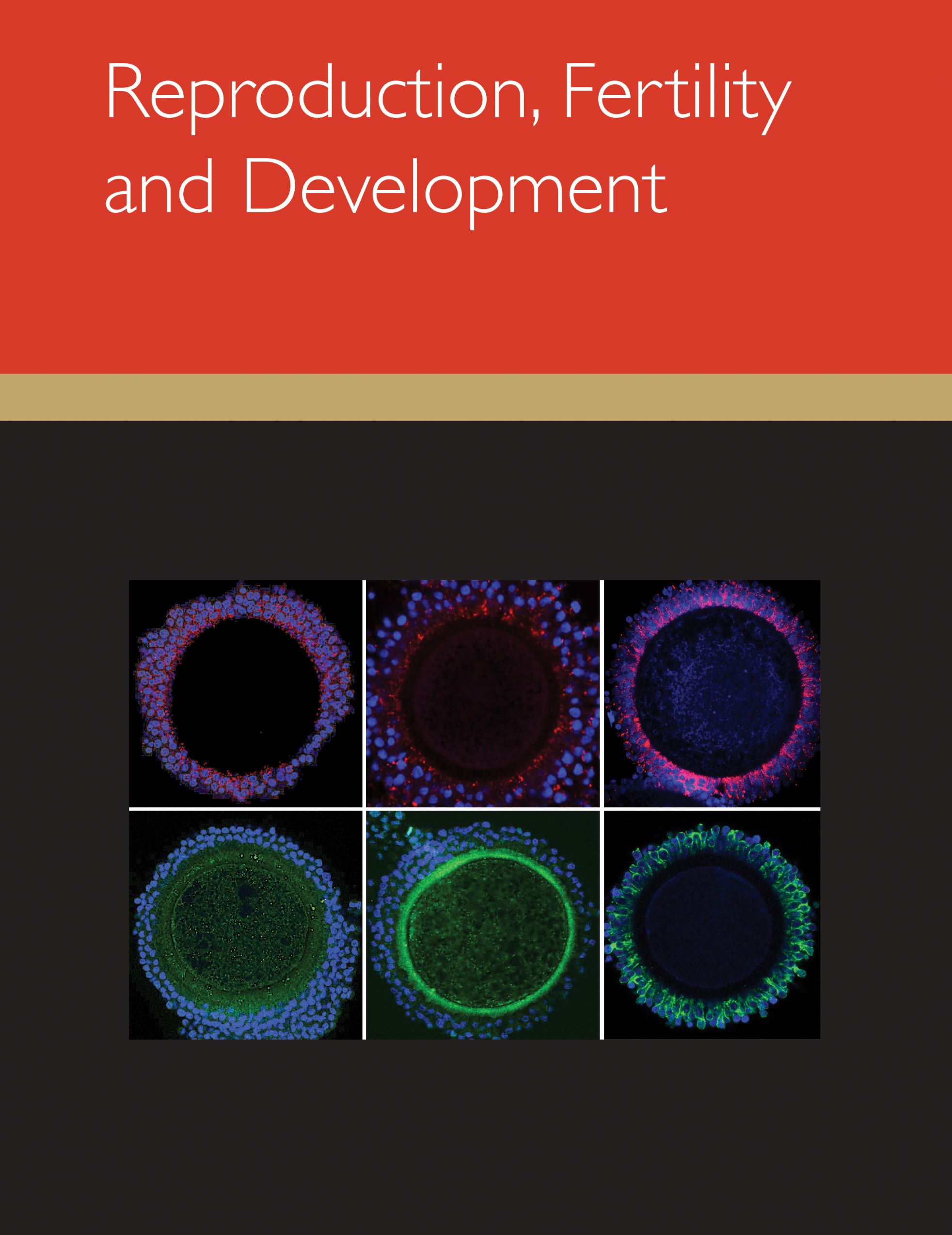 ALB, GPX5 and PTGDS as potential biomarkers for the aging processes of ...